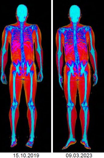 DEXA Body Composition Scan | Perth Dexa Scan DEXA Body Composition Scan | Perth Dexa Scan